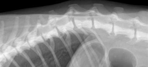 Rad Osteoporosis Functional Ileus Bronchointerstitial Lung Pattern