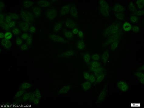 Junb Antibody 10486 1 Ap Proteintech