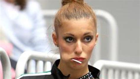 Гимнастичка от ансамбъла се контузи