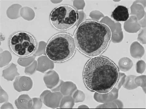 Cytoplasm Segmentation Results Granulometric Analysis Download