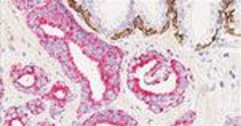 Leica Microsystems Launches The First Fully Automated One Step Dual Chromogen Ihc Detection