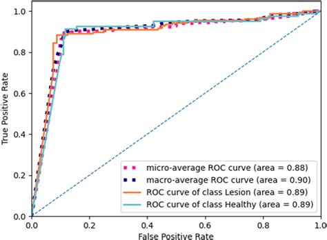 The Rocs And Auc Scores Of The Binary Classification Lesion And
