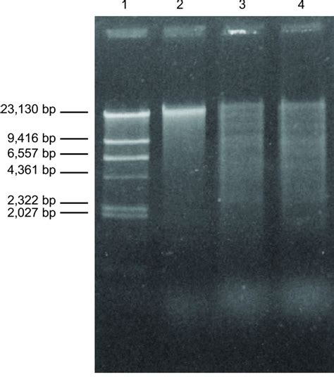 The Restriction Enzyme Digestion Of Extracted Dna Sample Lane 1 Size