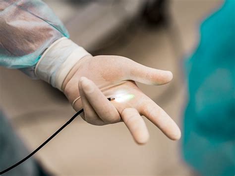 ERCP Procedure For Digestive Diseases Benefits And Risks