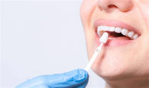 When Is Crown Or Cuspal Coverage Necessary After Root Canal Treatment