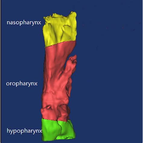 upper airway segmentation with mimics16 0 software download scientific diagram