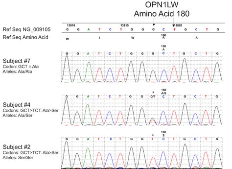 Representative Chromatograms Of Sequence Results Showing The Snp
