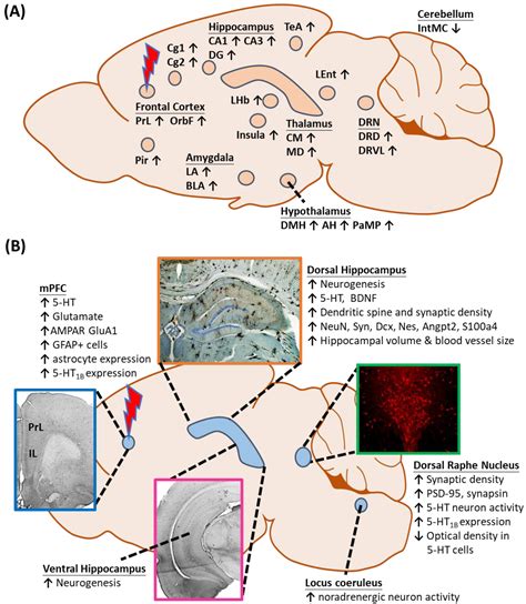 Subcallosal Gyrus