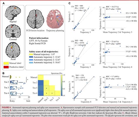 figure 4 from automated detection and surgical planning for focal