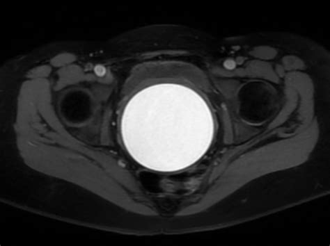 Image Radiopaedia Org