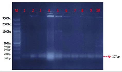Polymerase Chain Reaction Amplification Of Staphylococcus Download Scientific Diagram