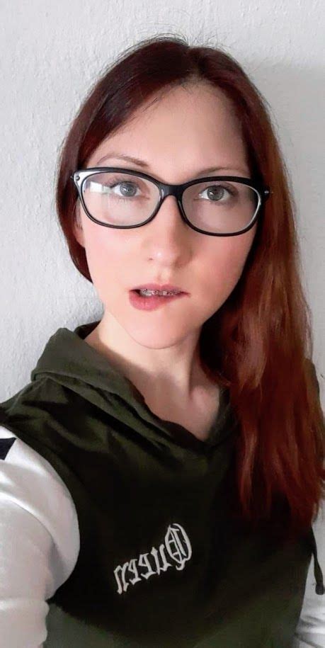 Sfw Braces Picture Scrolller