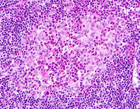 Langerhan Cells Histology