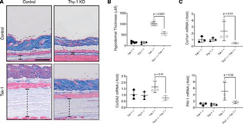 Figure 4 From Thy 1 Plays A Pathogenic Role And Is A Potential Biomarker For Skin Fibrosis In