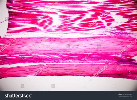 Bone Cross Section Under Microscope 1 Cut The Specimen To Create An