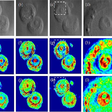 Pdf Optical Diffraction Tomography For High Resolution Live Cell Imaging