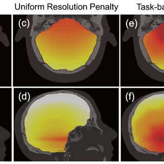 Maps of the regularization parameter β for the three penalty methods