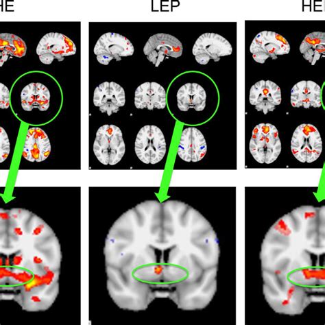 Neural Responses To Smoking Cues Scs Compared To Nonsmoking Cues Download Scientific Diagram