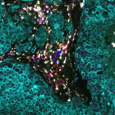 Immunosuppressive Brain Tumor Microenvironment A Barrier To Overcome Lunaphore Technologies