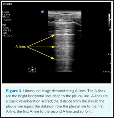Fpc Block 10 Flashcards Quizlet