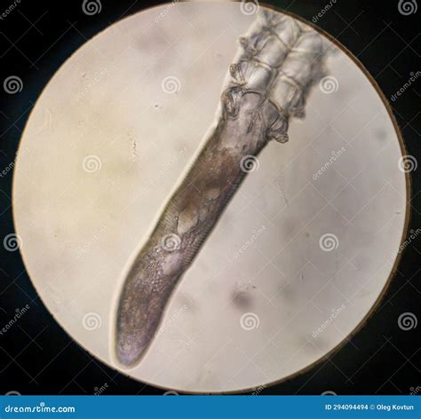 Demodex Mite From A Microscope View The Parasite Causing A Skin