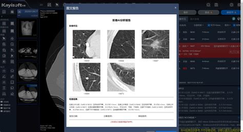 “基于区域影像云的ct肺结节ai分析服务”荣获2023 chitec数字医疗健康创新服务案例