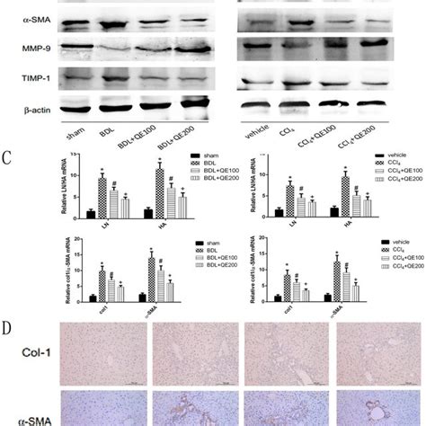Pdf Quercetin Prevents Hepatic Fibrosis By Inhibiting Hepatic