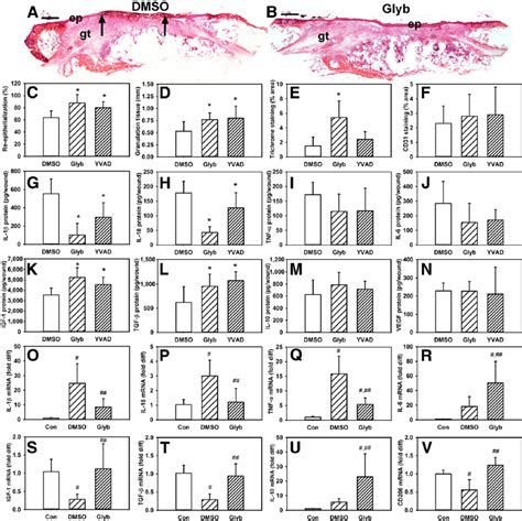 Blocking In Fl Ammasome Activity Downregulates The Proin Fl Ammatory