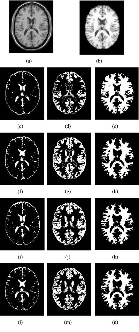 Figure 2 From A New Hybrid Image Segmentation Method Based On Fuzzy C