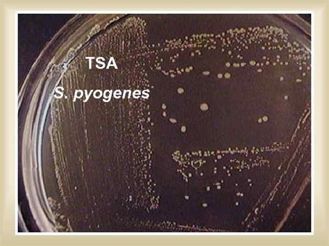 Streptococcus Enterococcus Review Bacterial Cell Morphology