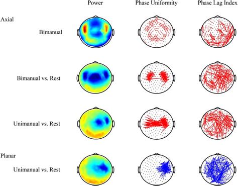 Volume Conduction Complicates The Interpretation Of Connectivity Download Scientific Diagram