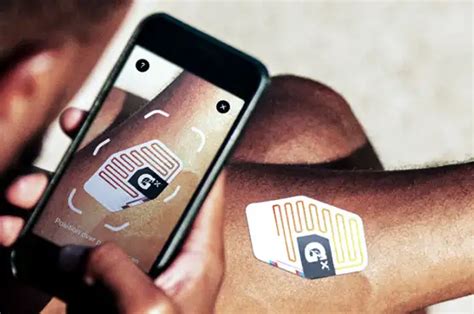 Epicore Biosystems Secures Additional 6m For Sweat Sensing Wearable Expansion