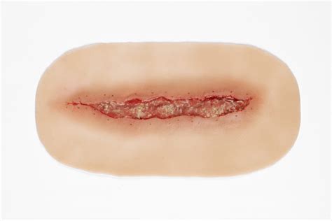 Dehiscence Medium Mediquip