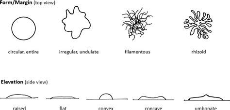 17 Colony Morphology Biology Libretexts
