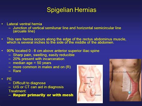 Inguinal Groin Hernia Symptoms Snte