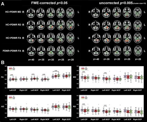 A The Result Of The Tbss Analysis In The Cerebellum For The Sake Of Download Scientific