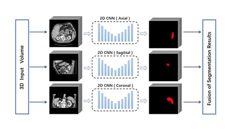 The Overall Workflow Of Multi View Fusion The 3d Input Volume Is Download Scientific Diagram