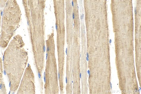 Calmodulin 1 2 3 Antibody 28270 1 Ap Proteintech