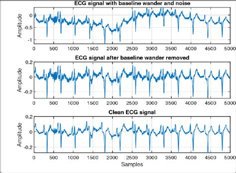 Figure From Light Weight Neural Network For ECG And EEG Anomaly Detection In IOT Edge Sensors