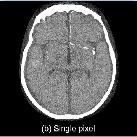 comparison of pcct images acquired using three different pcd detection
