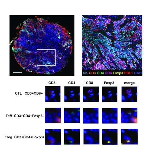 Opal Seven Color Multiplex Analysis Of Npc Tumor Tissue Identifies Download Scientific Diagram