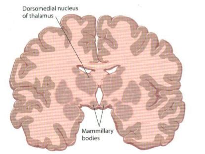 Lecture 7 Memory And The Temporal Lobe Flashcards Quizlet