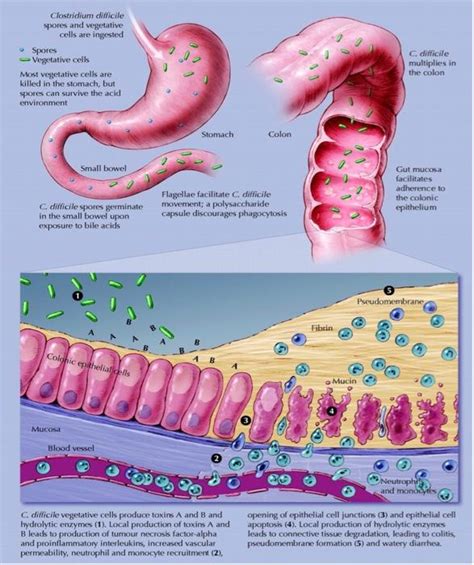 Solved At The End Of The Case Is A Picture Of The