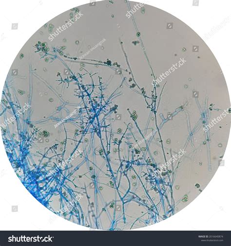 현미경으로 400 X 아래 트리코더마 하르지아눔 스톡 사진 2016640874 Shutterstock