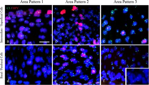 Fluorescence In Situ Hybridization Targeting Copy Number Variations For Download Scientific