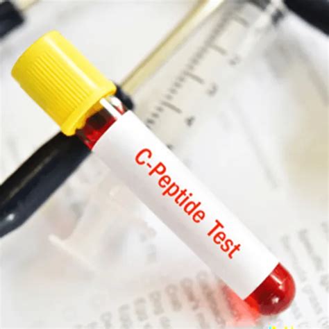 C Peptide Test Near You In Delhi Book Test At Low Price