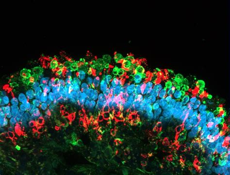 Testing New Aav Vector On Fully Differentiated Retinal Tissue In Vitro