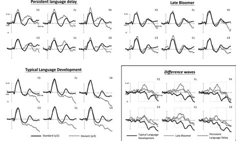 Grand Average Waveforms Of The Standard And Deviant Stimuli For The