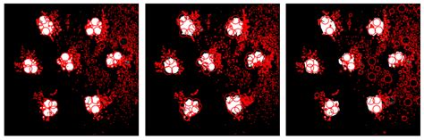 Image Processing — Blob Detection By Ralph Caubalejo Towards Data
