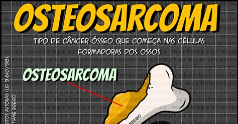 Osteosarcoma Enfermagem Ilustrada